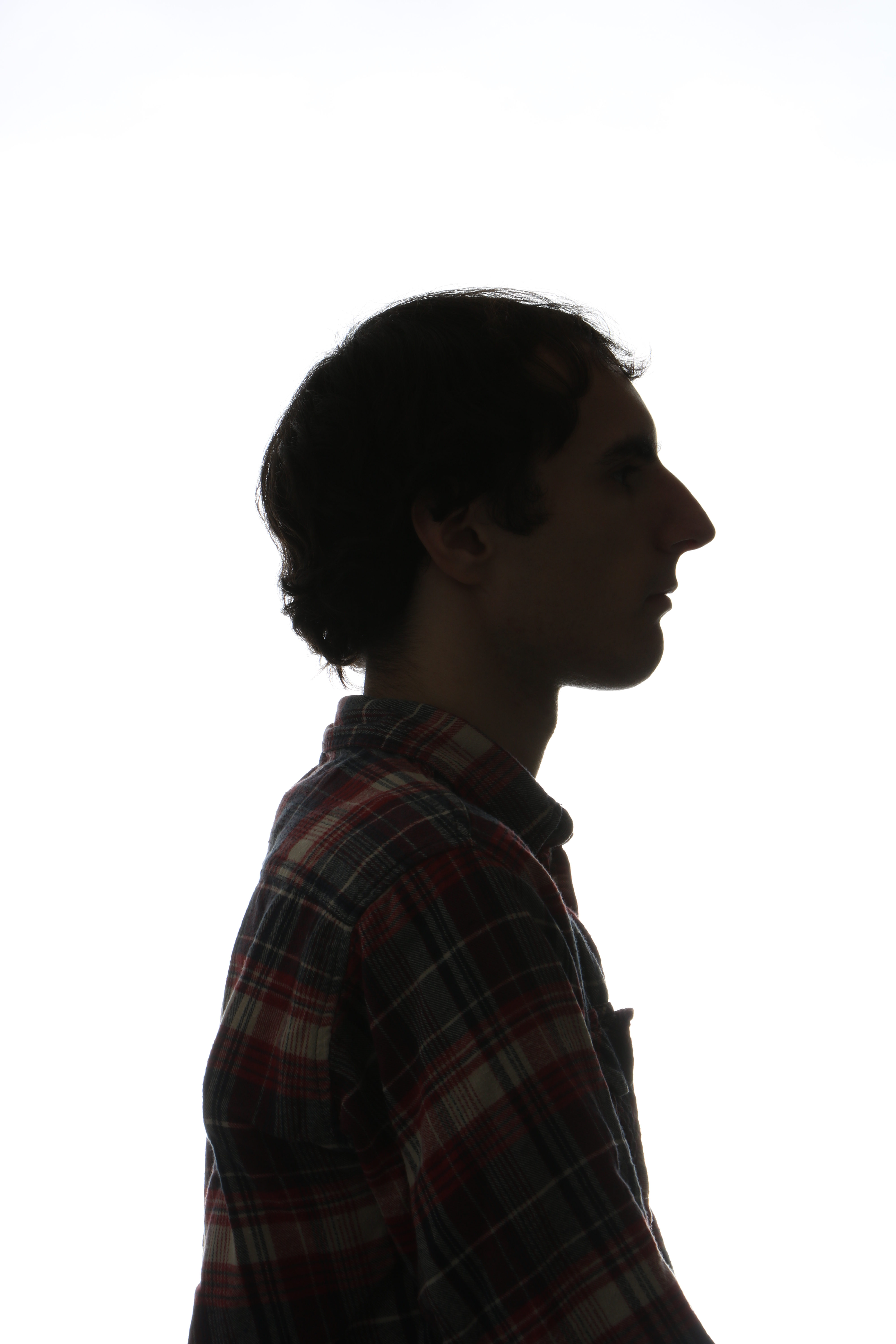 The intense migraine I suffer